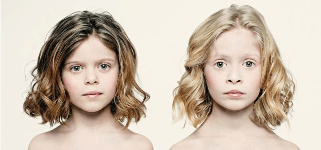 Hiện Tượng Chimerism - Sinh Ra Con Nhưng Không Phải Cha Ruột