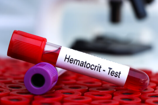 Xét nghiệm Hematocrit - NOVAGEN