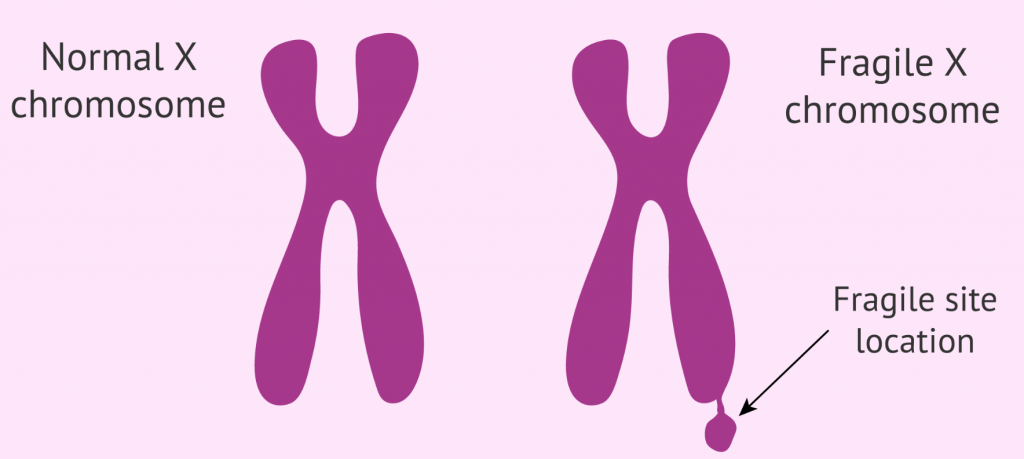 Hội chứng Fragile X - NOVAGEN